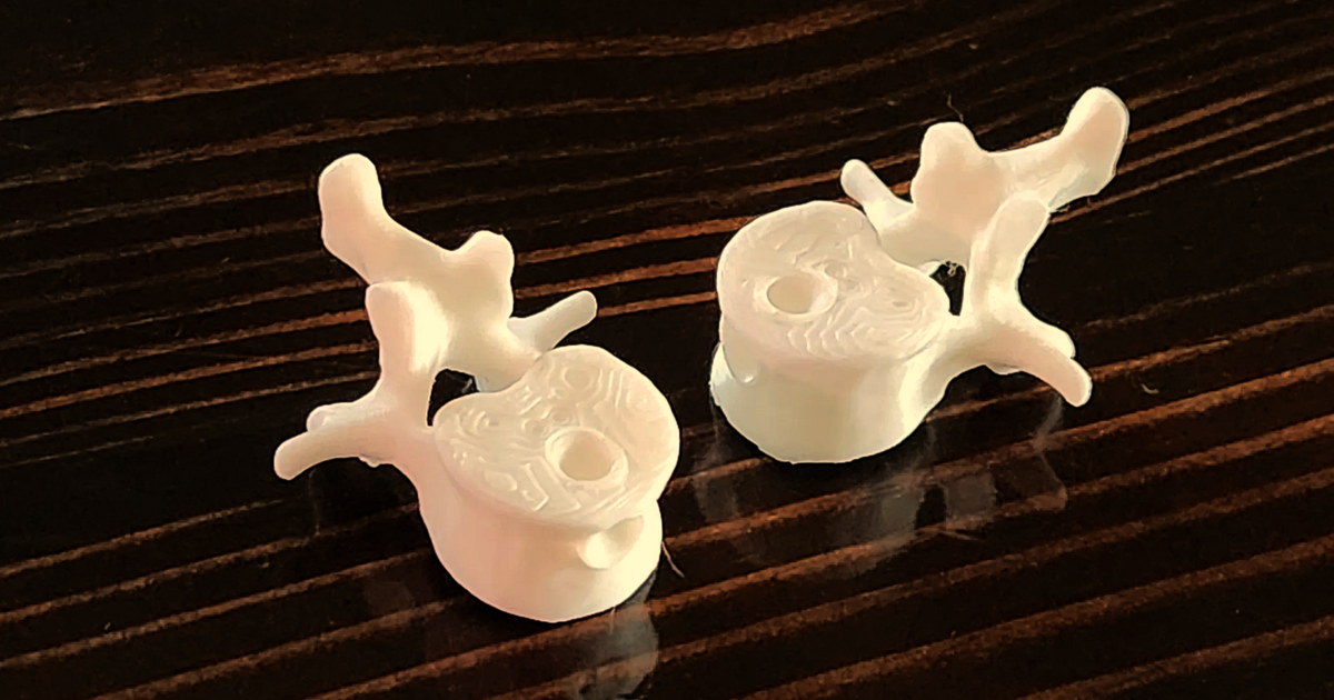 Lumbar Vertebrae Keychain by Epiales | Download free STL model ...