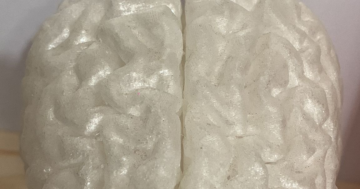 brain with stand by Luigi Ragozzino | Download free STL model ...