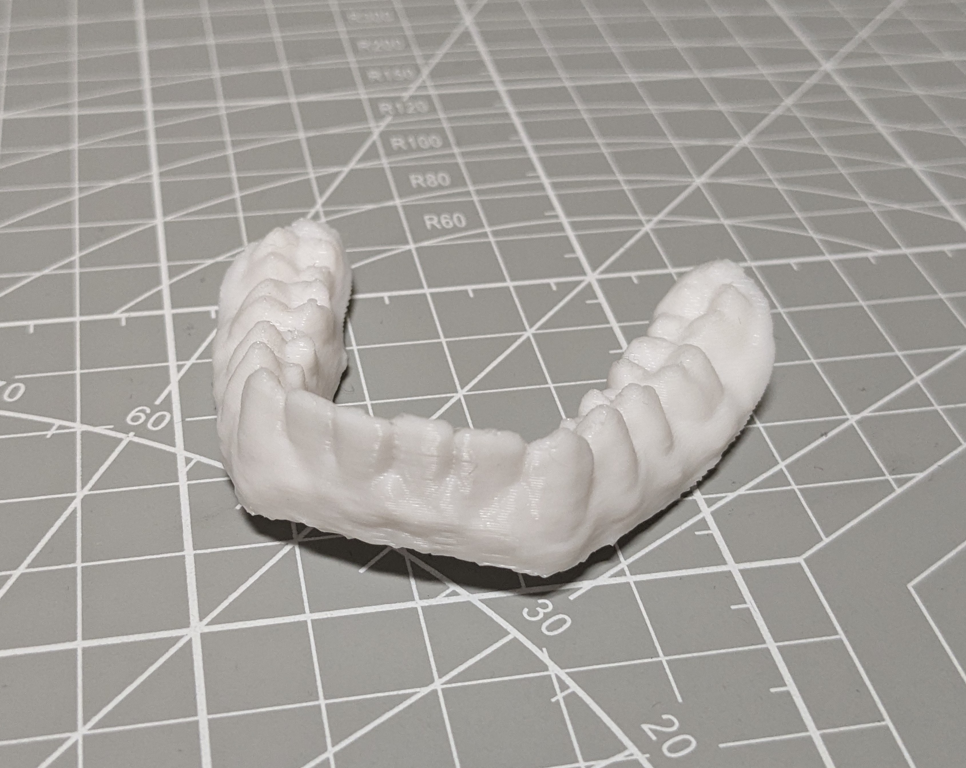A real 3d scan of my teeth by Odbix | Download free STL model ...