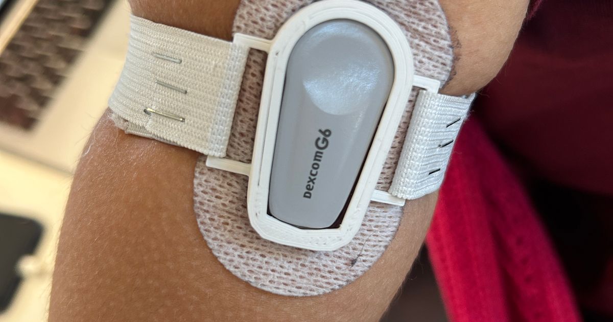 Dexcom G6 sport sensor support by Jasone7149 | Download free STL model ...