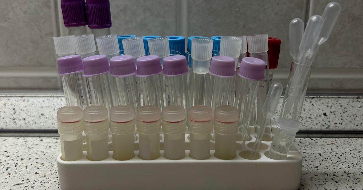 Test tube stand by 3dprint.mf | Download free STL model | Printables.com