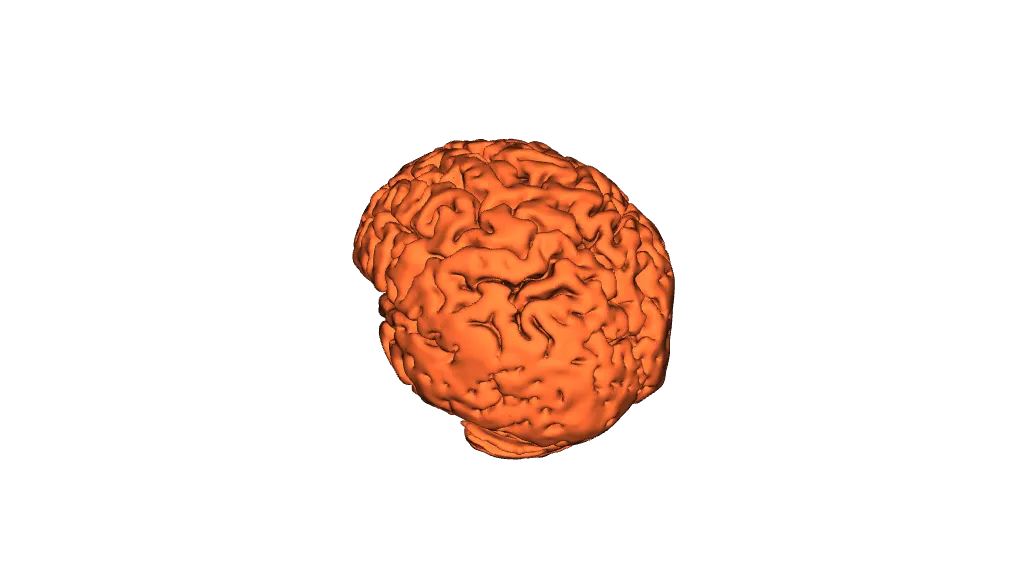 MRI Brain Scan by kiliankoe | Download free STL model | Printables.com
