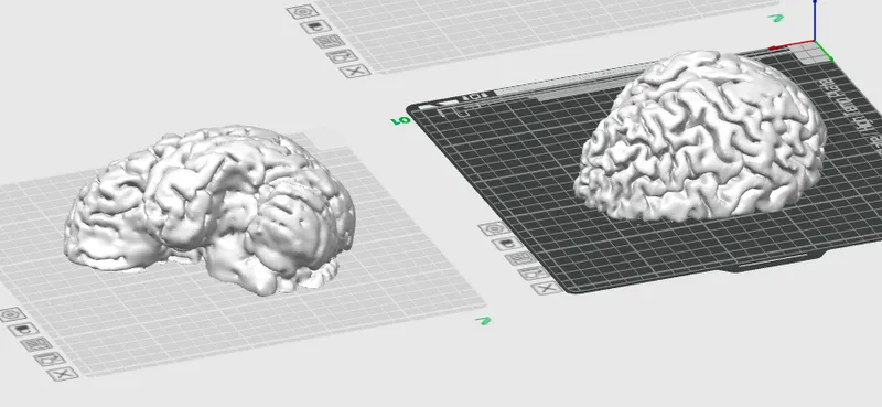 MRI Brain Scan by kiliankoe | Download free STL model | Printables.com