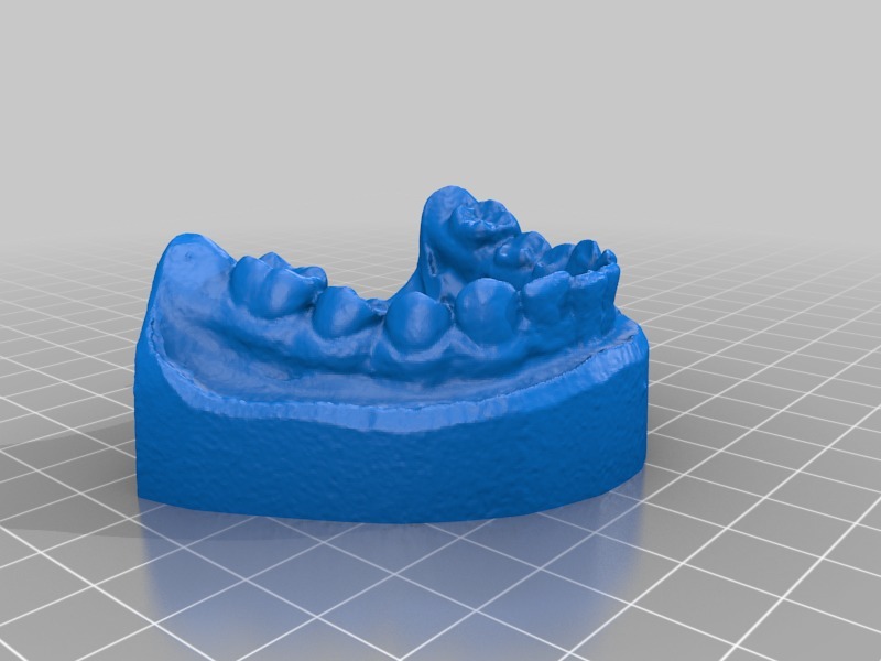 Set of teeth - dental model - 3D Scan (test with Raspi Cam) by openscan ...