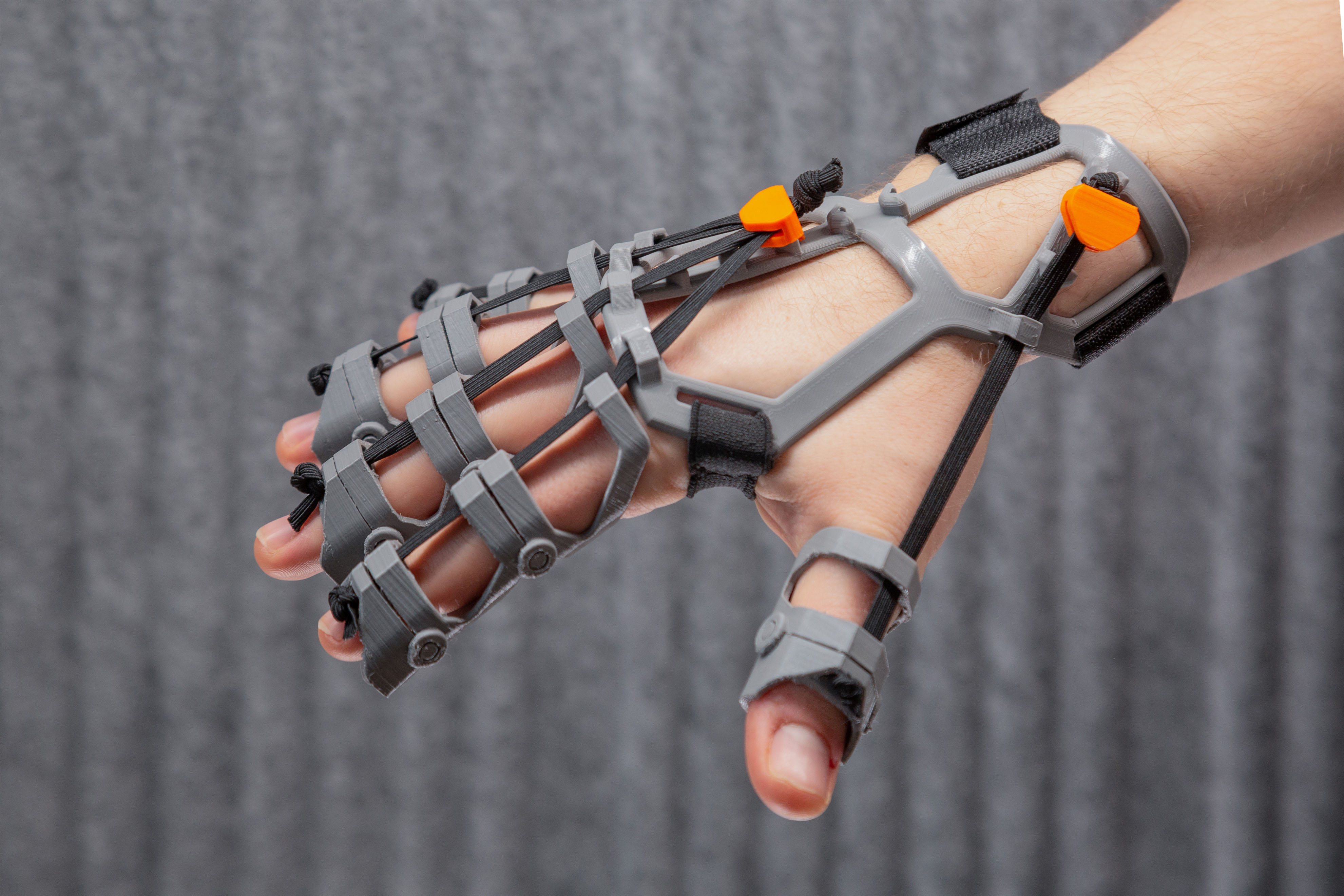 Improving fine motor skills, designing a 3D FDM printed orthosis to ...