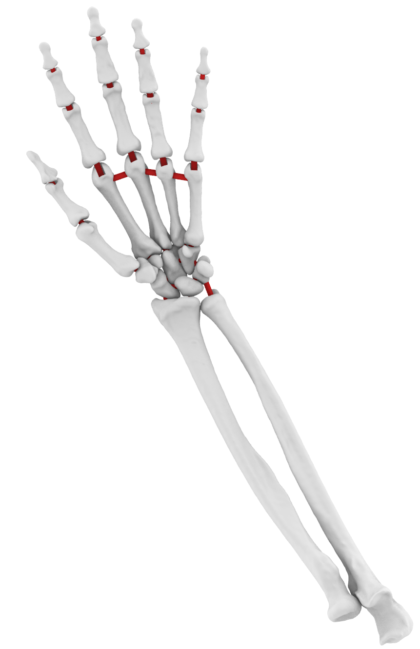 Life-sized Flexible Forearm by Karel Pěnička | Download free STL model ...