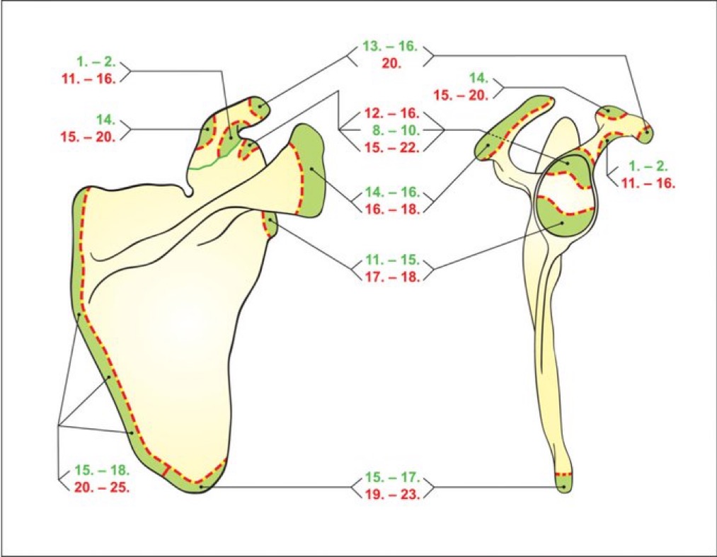 Scapula fracture model von David Bennett MD | Kostenloses STL-Modell ...