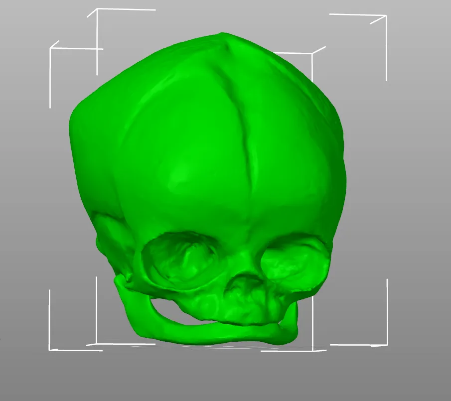 Newborn Baby Skull by Skeleton Dan | Download free STL model ...