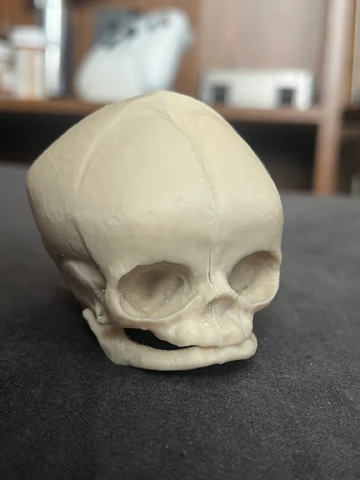 Newborn Baby Skull by Skeleton Dan | Download free STL model ...