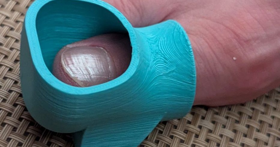 Toe nail treatment cradle by ToyBear | Download free STL model ...