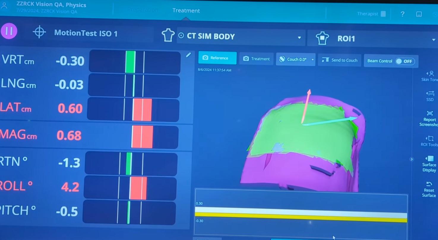 SGRT Breathing Phantom by MakingMedicalPhysics | Download free STL ...